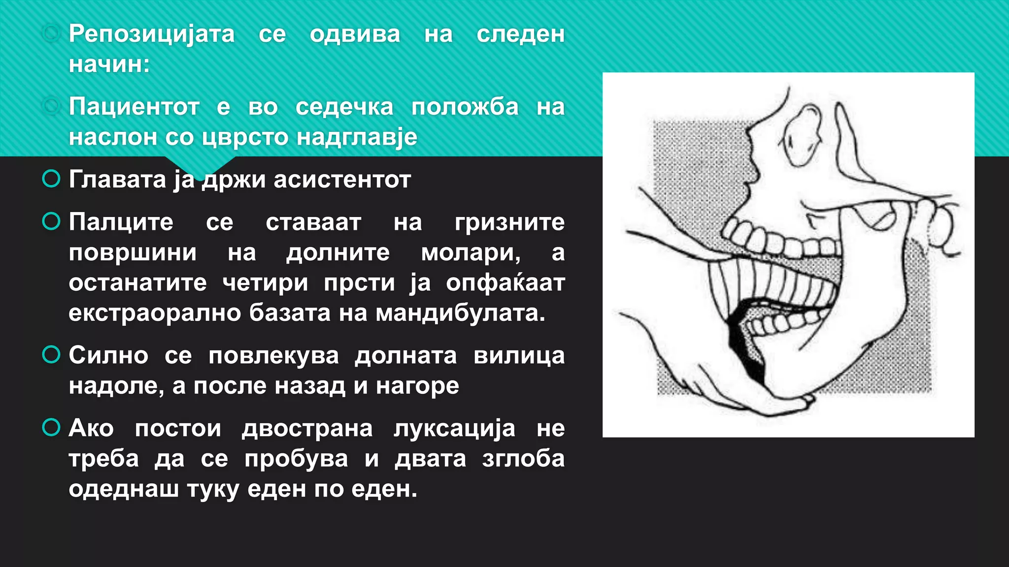 Luksacija na TMZ.pptx