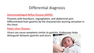 luloosfsgagwgag ppt ahahahagsvsvgastritis.pptx