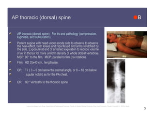 lumber spine radiography .ppt