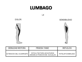 Lumbago | PPTX