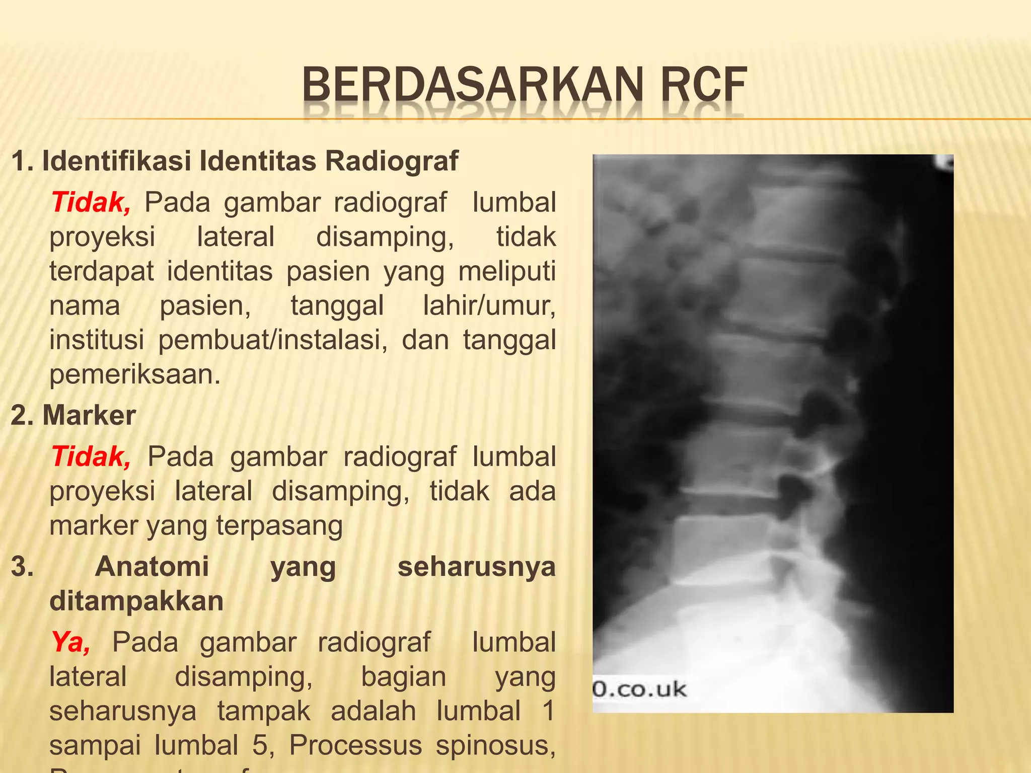 ppt kritisi dan evaluasi radiograf Lumbal dan Lumbosacral | PPTX