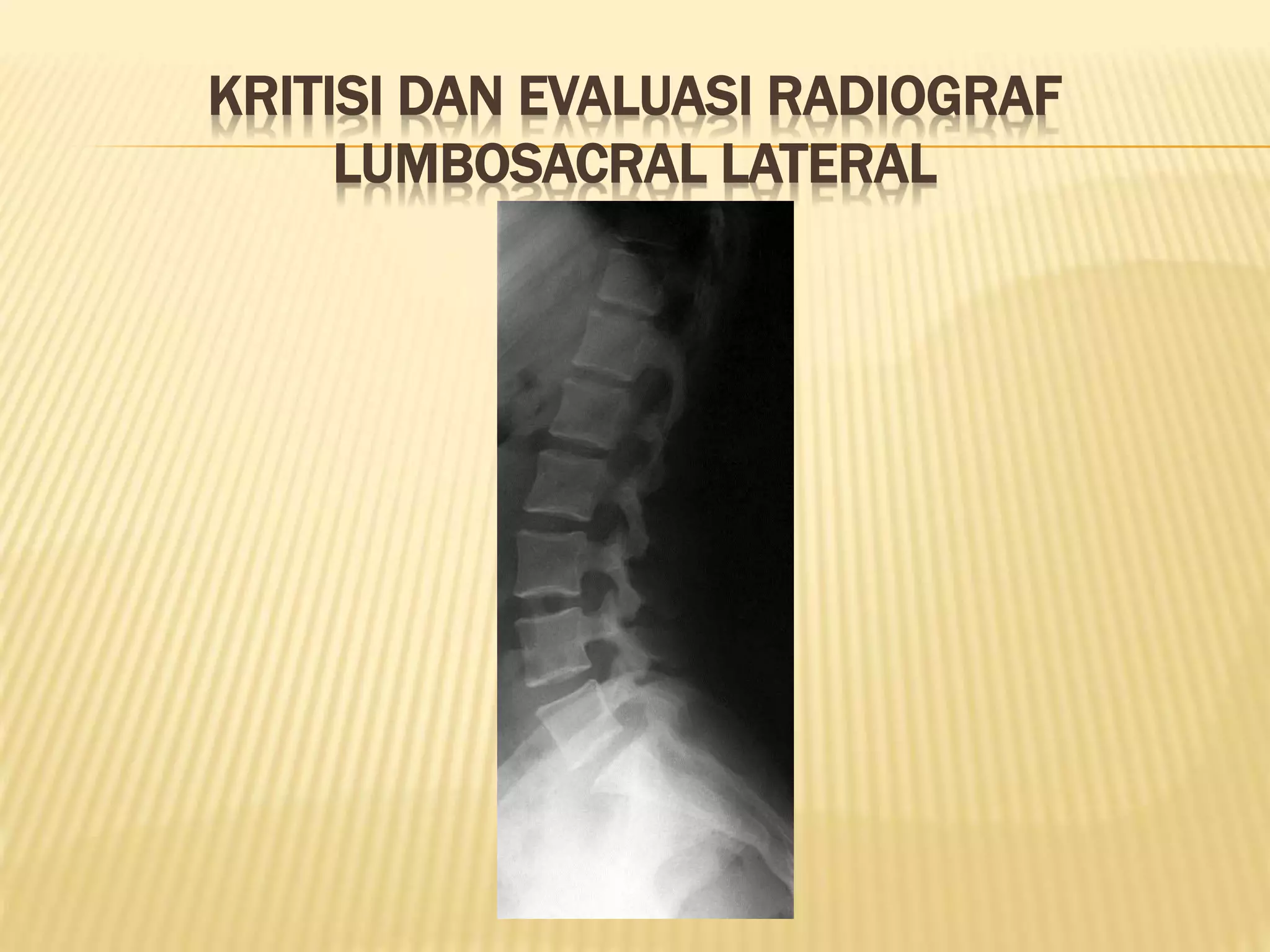 ppt kritisi dan evaluasi radiograf Lumbal dan Lumbosacral | PPTX