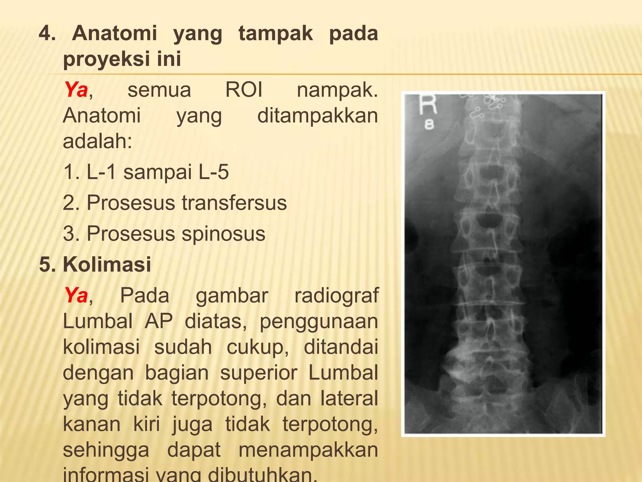 ppt kritisi dan evaluasi radiograf Lumbal dan Lumbosacral | PPTX