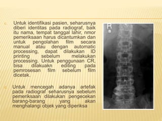 ppt kritisi dan evaluasi radiograf Lumbal dan Lumbosacral | PPTX