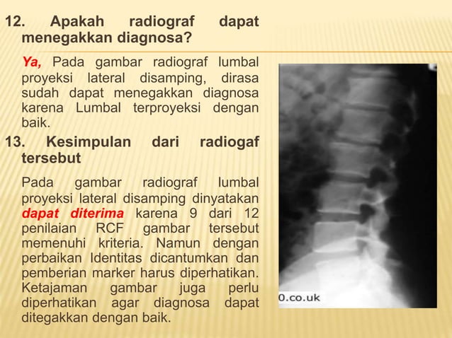 ppt kritisi dan evaluasi radiograf Lumbal dan Lumbosacral | PPTX