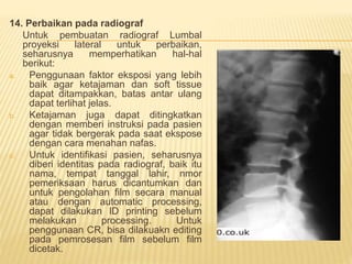 ppt kritisi dan evaluasi radiograf Lumbal dan Lumbosacral | PPTX