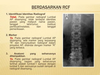ppt kritisi dan evaluasi radiograf Lumbal dan Lumbosacral | PPTX