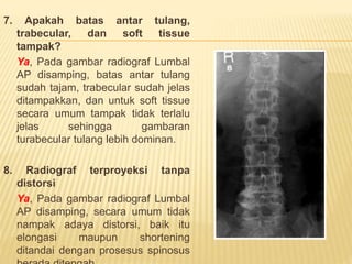 ppt kritisi dan evaluasi radiograf Lumbal dan Lumbosacral | PPTX