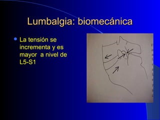 Lumbalgia | PPT