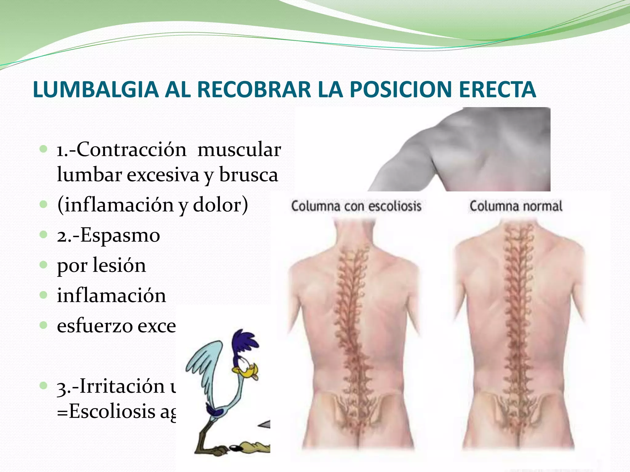 Nosología de Lumbalgia | PPT