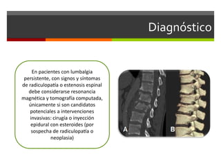 Lumbalgia | PPTX