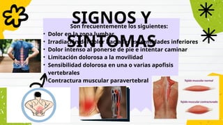 LUMBALGIA, clasificacion signos y sintmas | PPTX