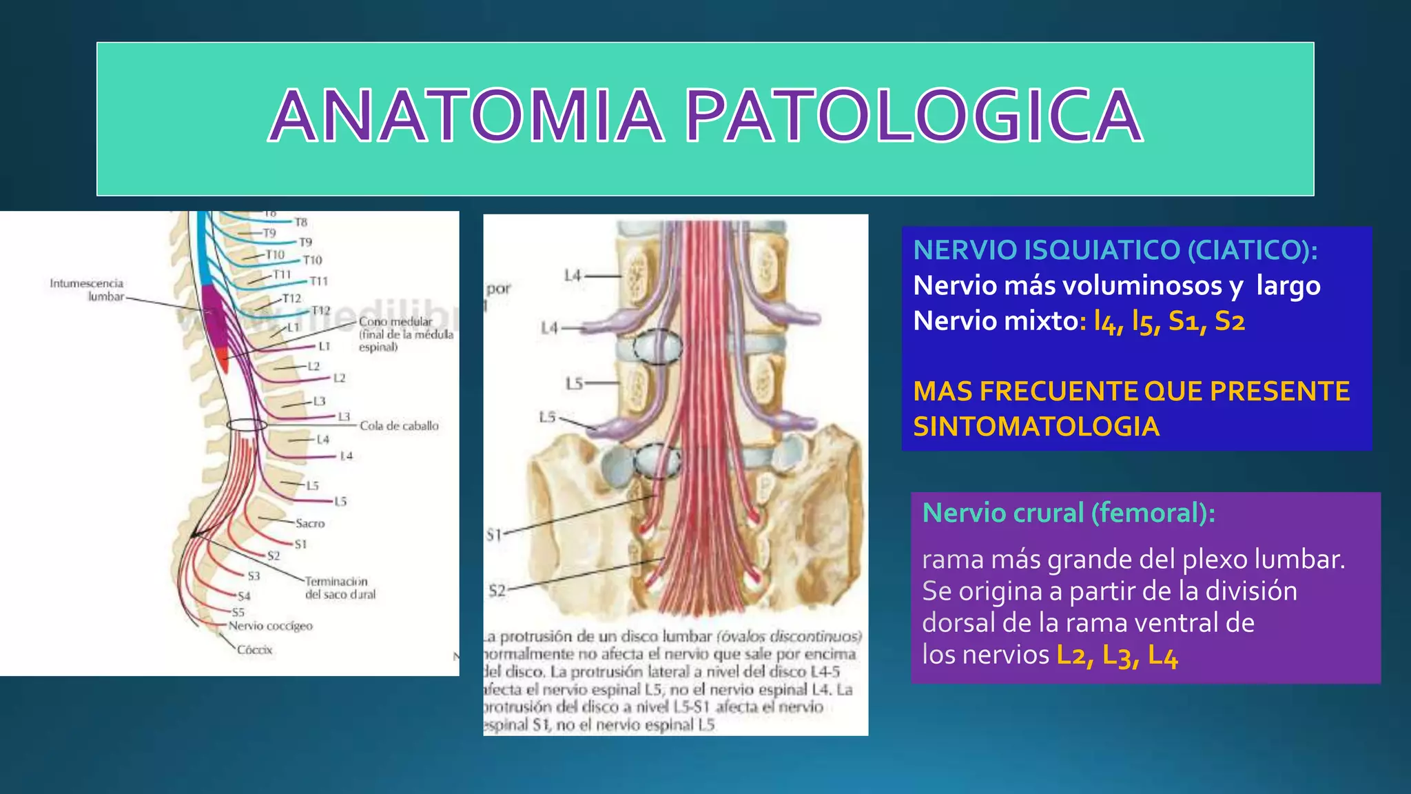 Lumbalgia y lumbociatica | PPTX
