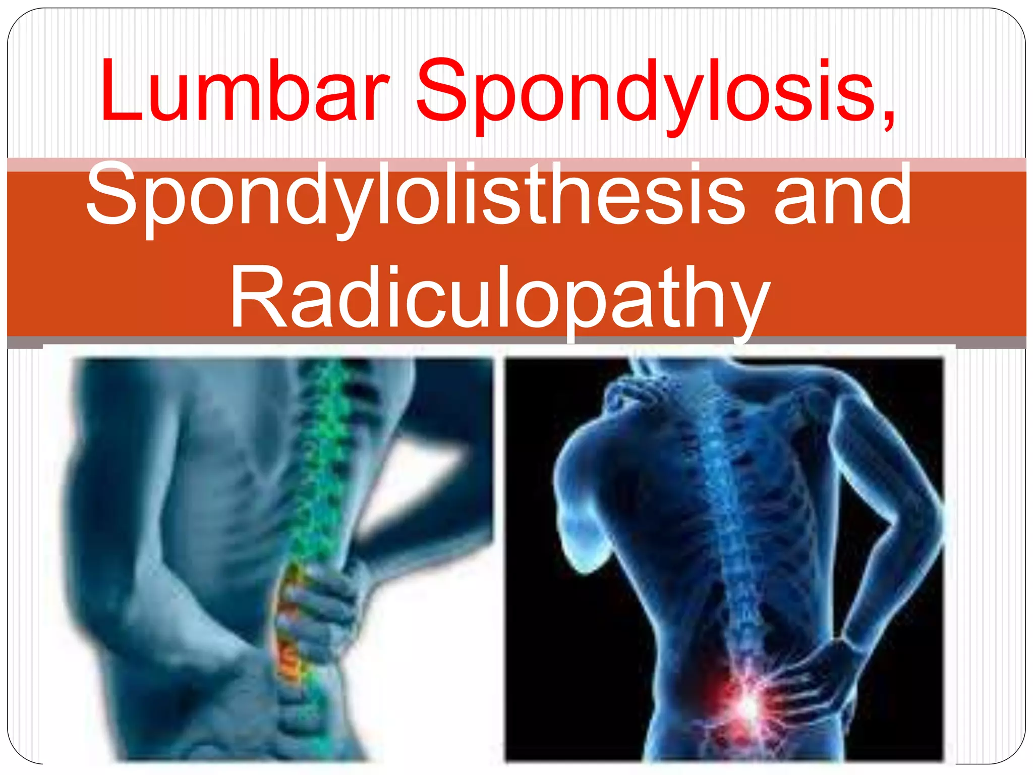Lumbar Spondylosis, Spondylolisthesis and Radiculopathy | PPTX