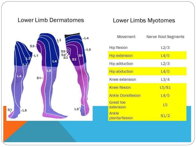Lumbar Spondylosis, Spondylolisthesis and Radiculopathy | PPTX | Death ...