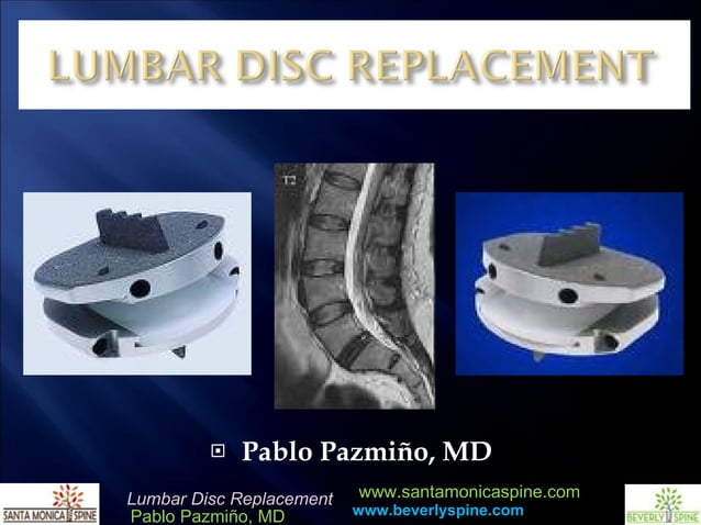 Lumbar Disc Replacement | PPT | Physical Therapy | Wellness