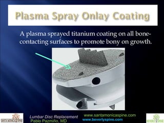 Lumbar Disc Replacement | PPT