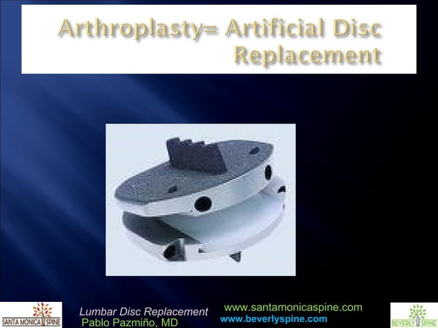 Lumbar Disc Replacement | PPT | Physical Therapy | Wellness
