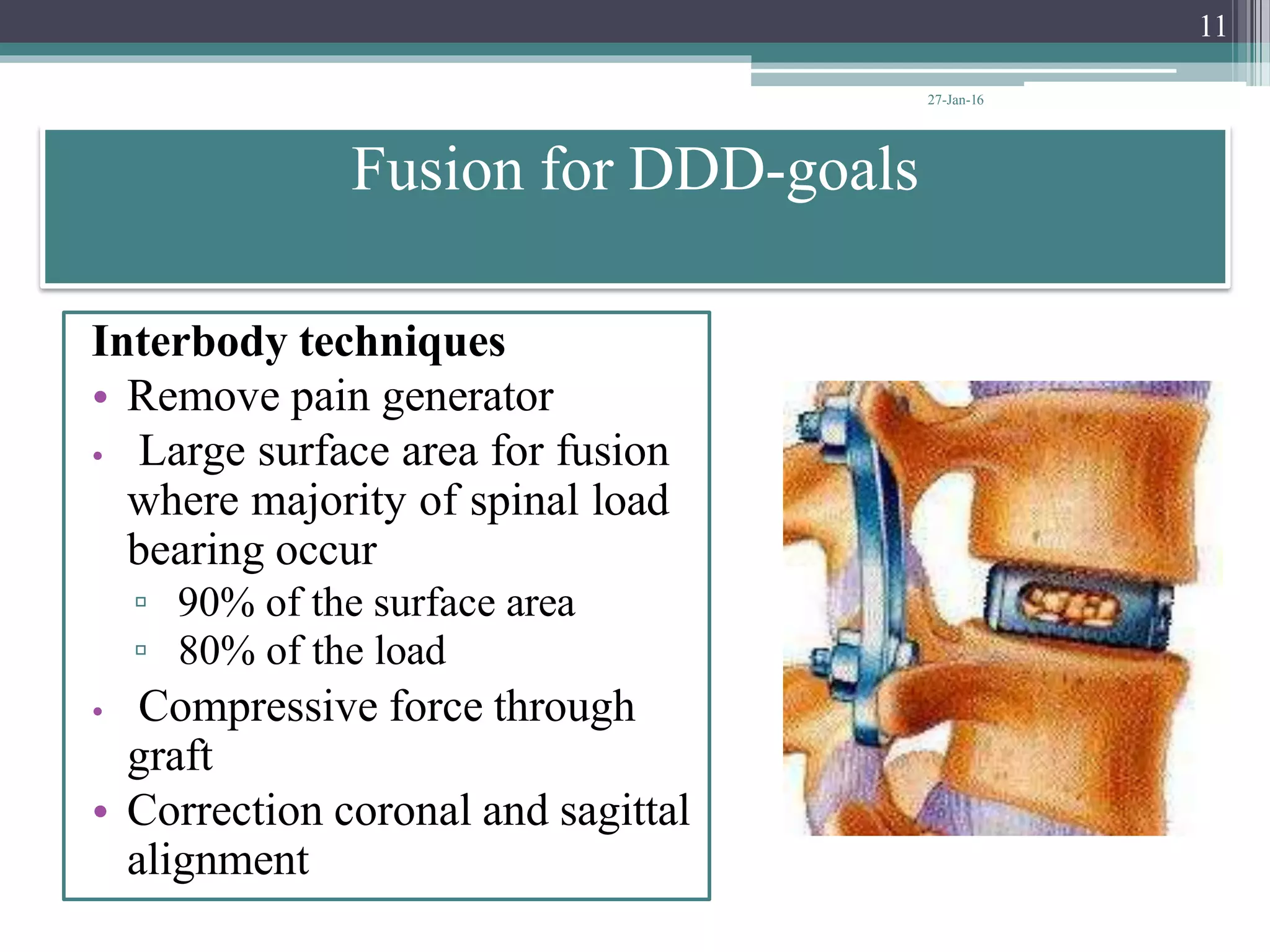 lumbar-interbody-fusionindications-techniques-and-complications ...