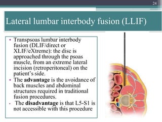 lumbar-interbody-fusionindications-techniques-and-complications ...