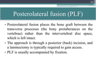 lumbar-interbody-fusionindications-techniques-and-complications ...