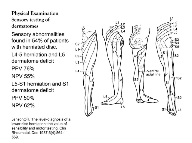 lumbar-radiculopathy estudio clinico.pdf | Free Download