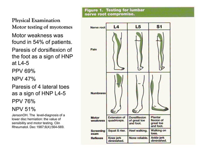 lumbar-radiculopathy estudio clinico.pdf