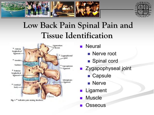 lumbar-radiculopathy estudio clinico.pdf