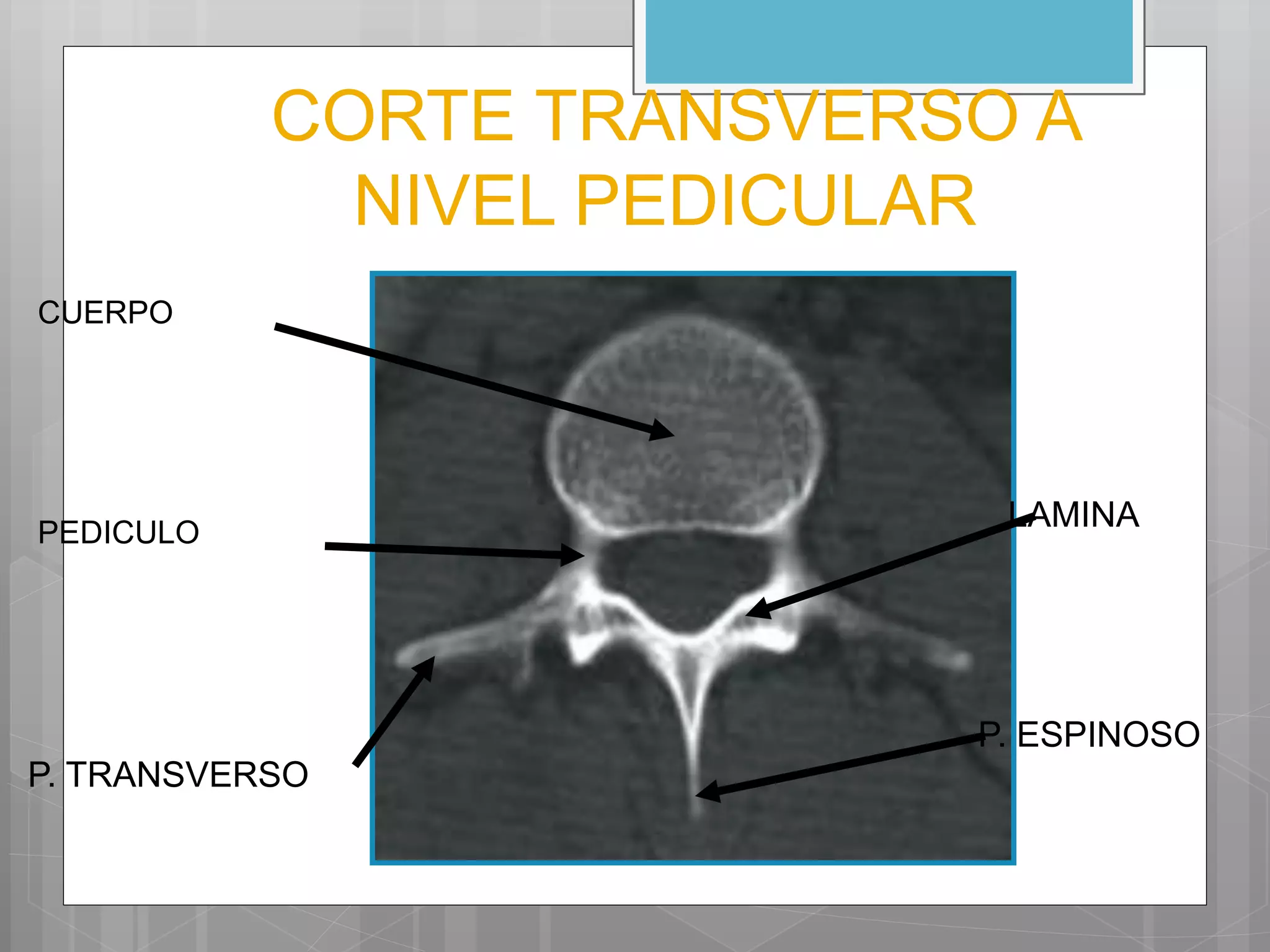 Radiología de la Columna | PPTX