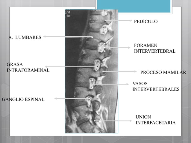 Radiología de la Columna | PPTX