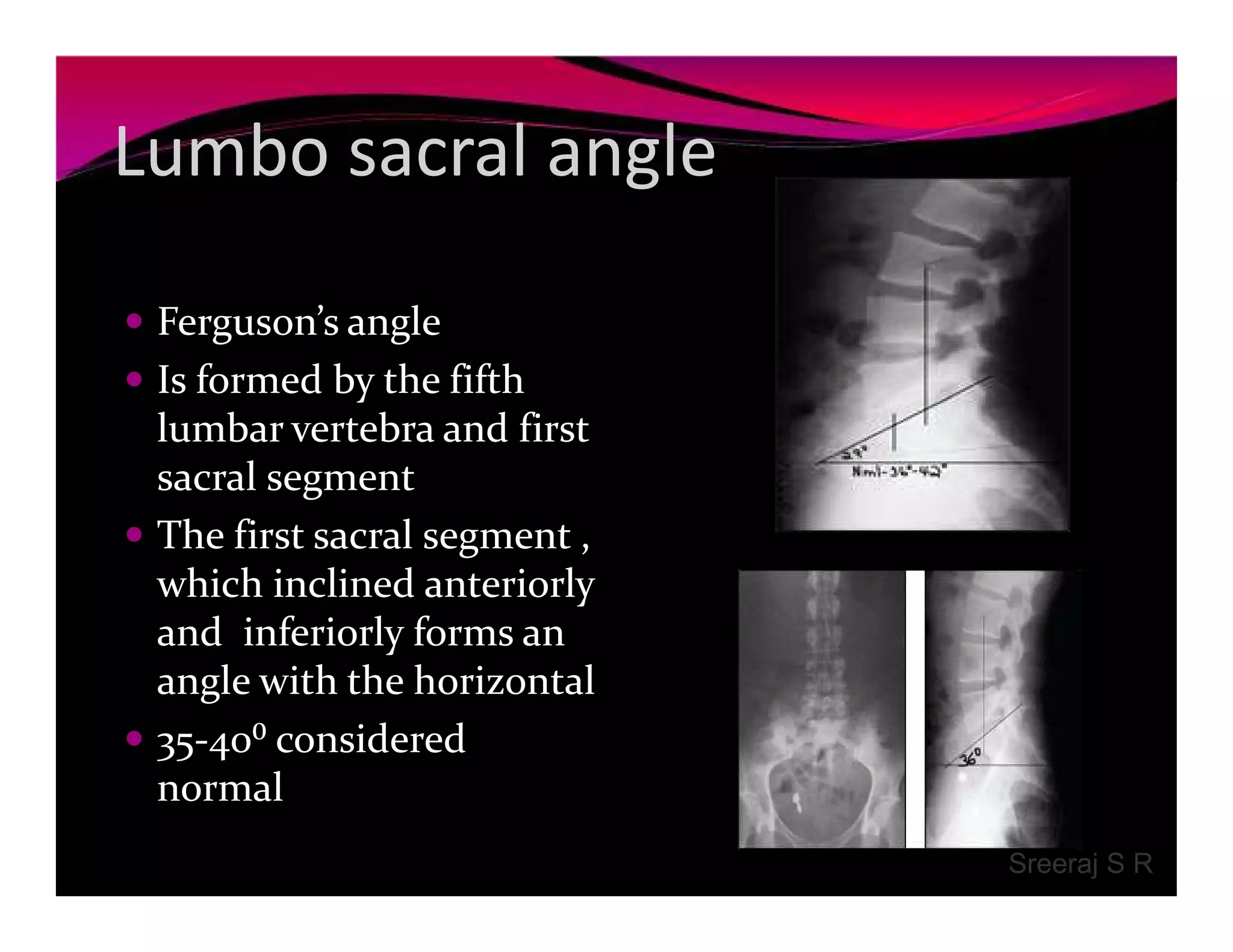 Lumbar and sacral Biomechanics | PDF
