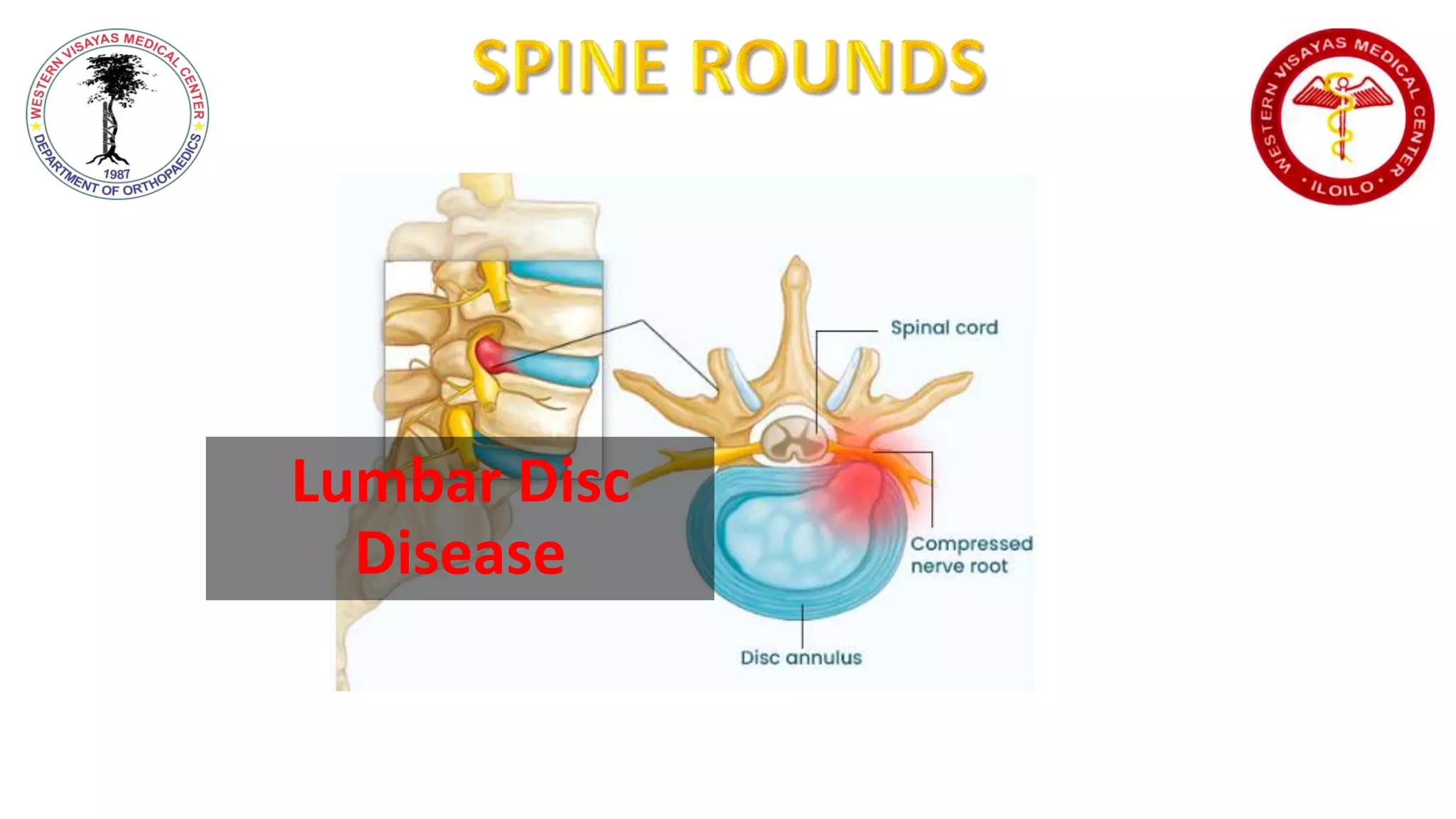 LUMBAR DISC DIEASE 1.3.pptx