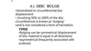 LUMBAR DISC DIEASE 1.3.pptx