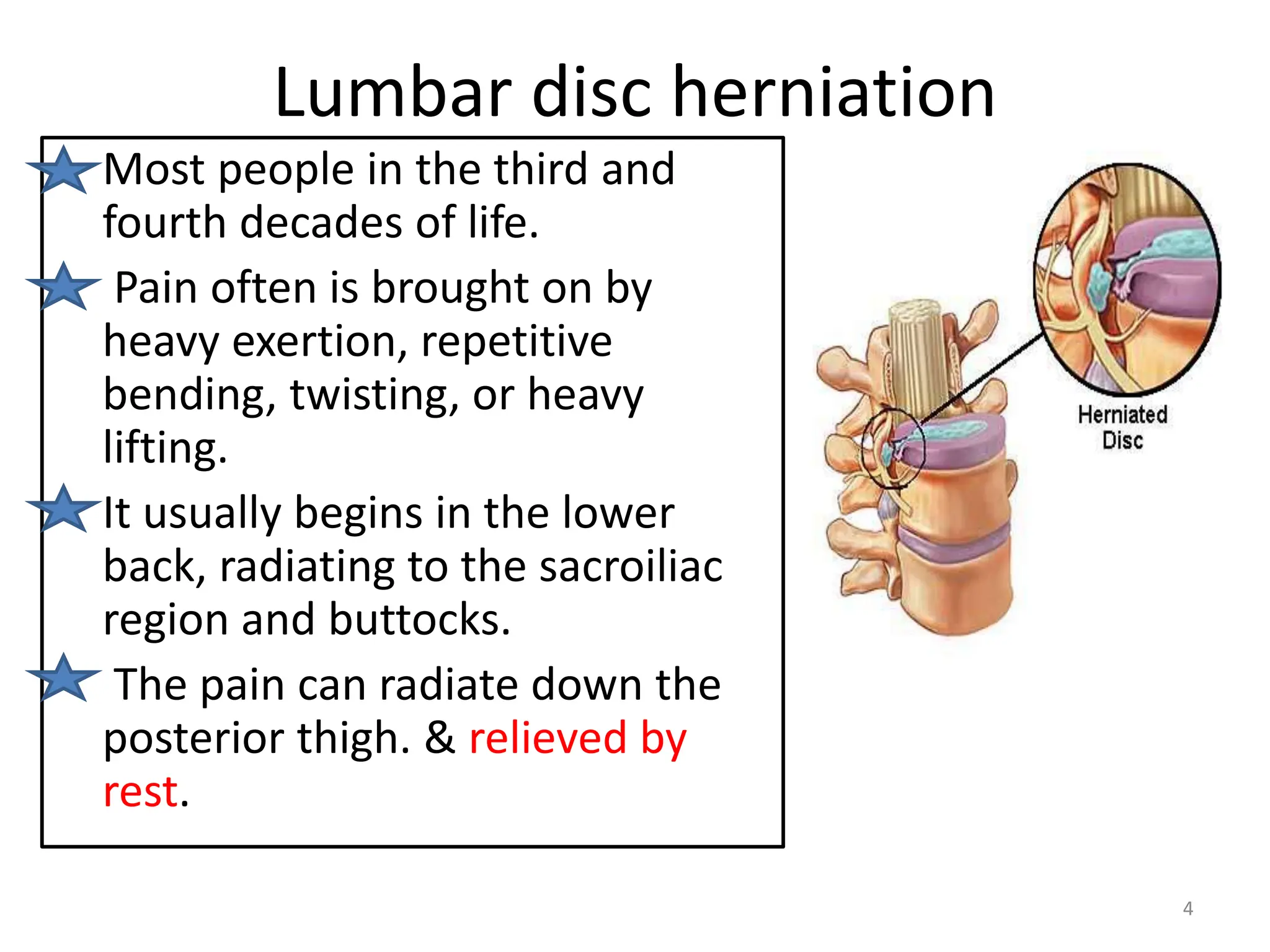 LUMBAR DISC HERNIATION CAMPBELLS ORTHOPEDIC | PPTX