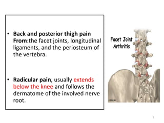 LUMBAR DISC HERNIATION CAMPBELLS ORTHOPEDIC | PPTX