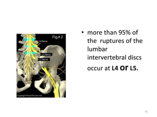 LUMBAR DISC HERNIATION CAMPBELLS ORTHOPEDIC | PPTX