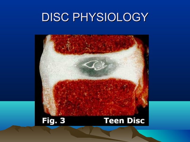 Lumbar disc presentation dr ajay bajaj neurosurgeon | PPT