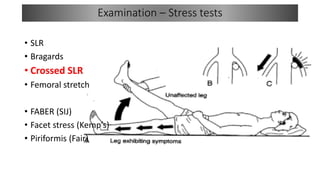 Lumbar Disc prolapse - Basics.pptx