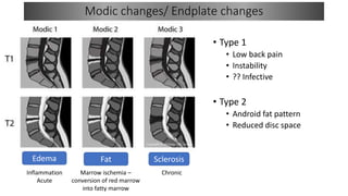 Lumbar Disc prolapse - Basics.pptx