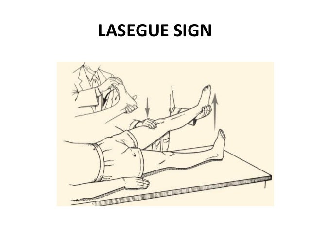 Lumbar disc prolapse