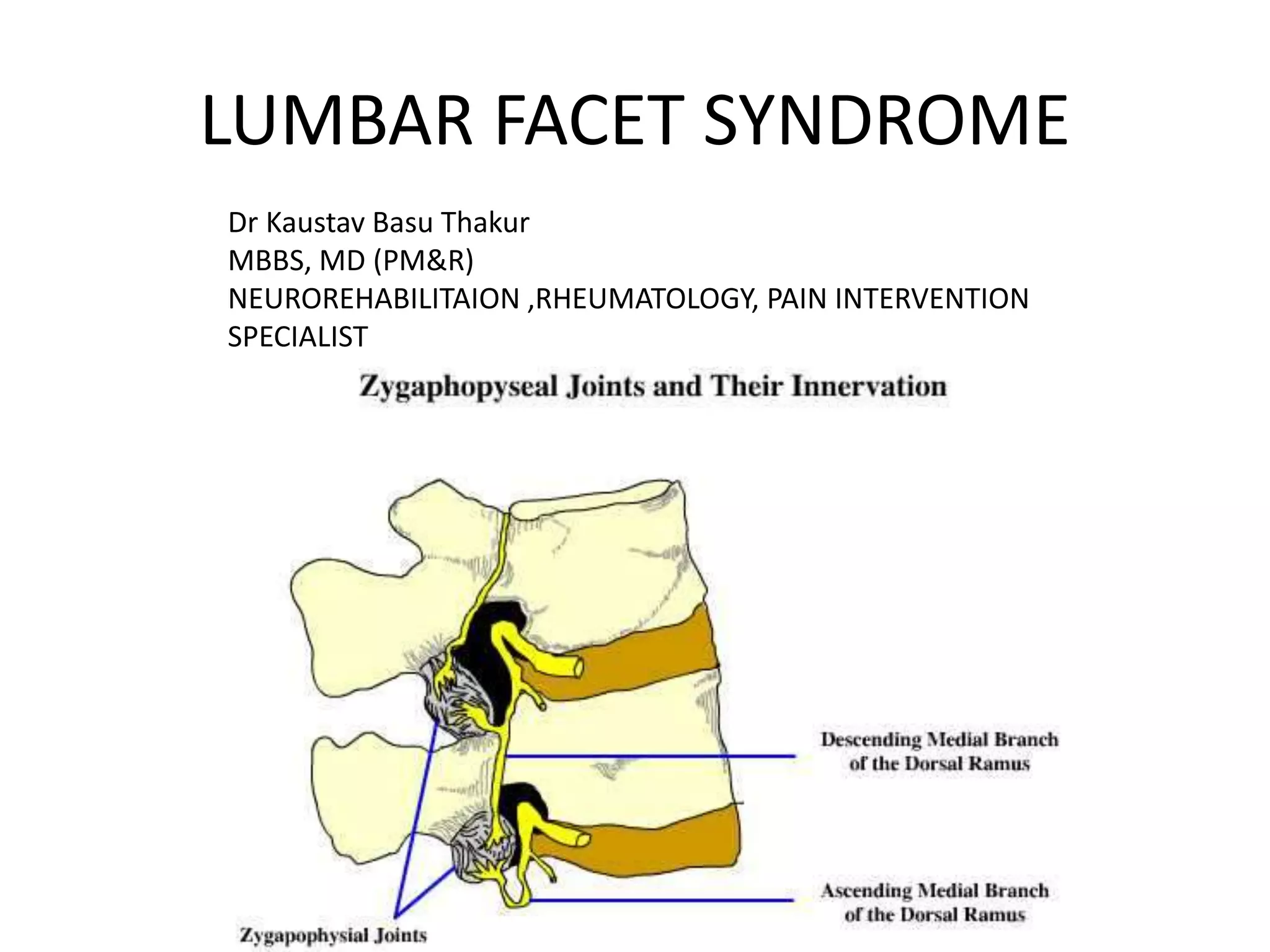 Lumbar facet syndrome | PPTX