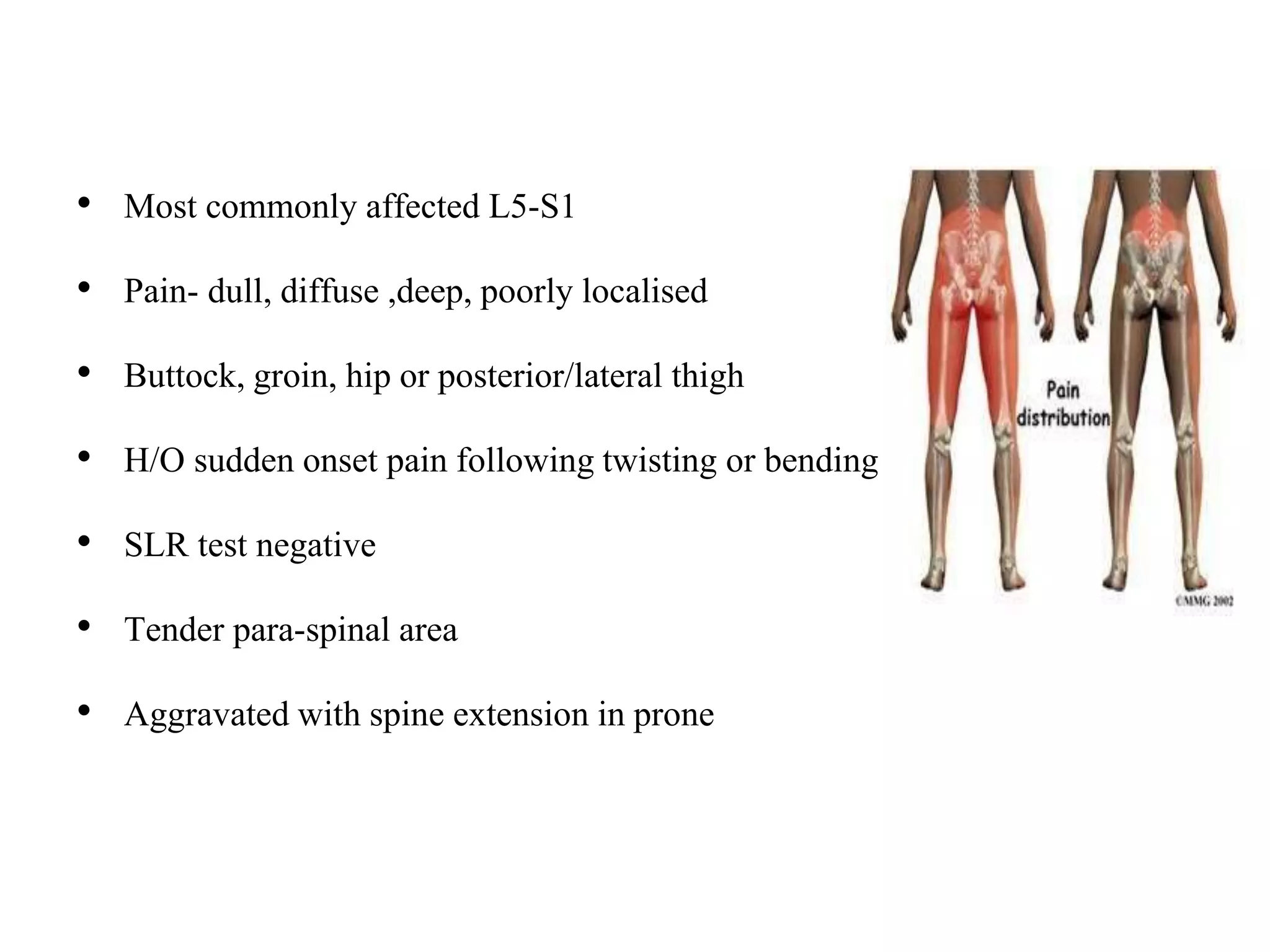 Lumbar facet syndrome | PPTX