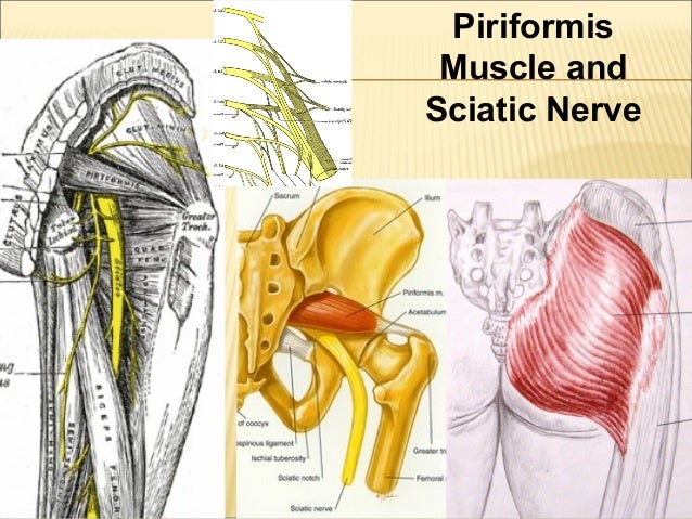 Lumbar Spine and Sciatica