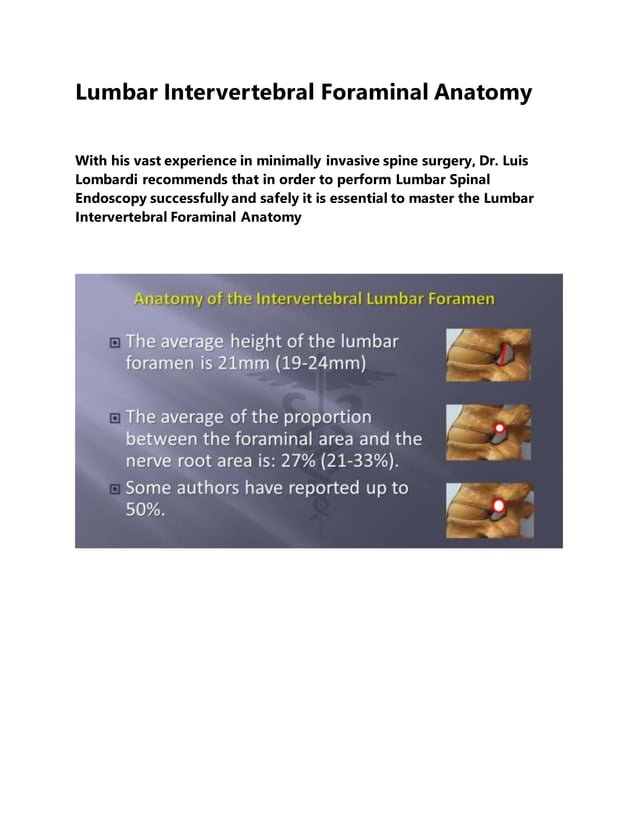 Lumbar intervertebral foraminal anatomy | DOCX | Death, Injury, or ...