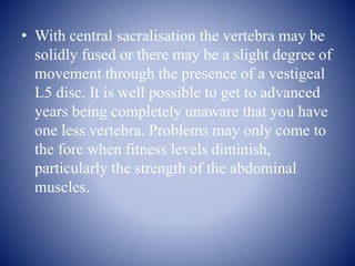 lumbarisation.pptx