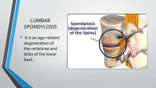 Lumbar Pathologies.pptx