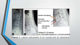 Lumbar Pathologies.pptx