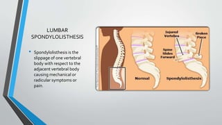 Lumbar Pathologies.pptx