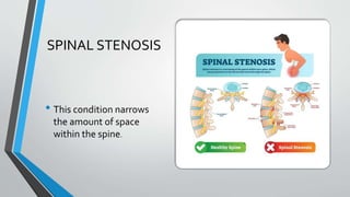 Lumbar Pathologies.pptx