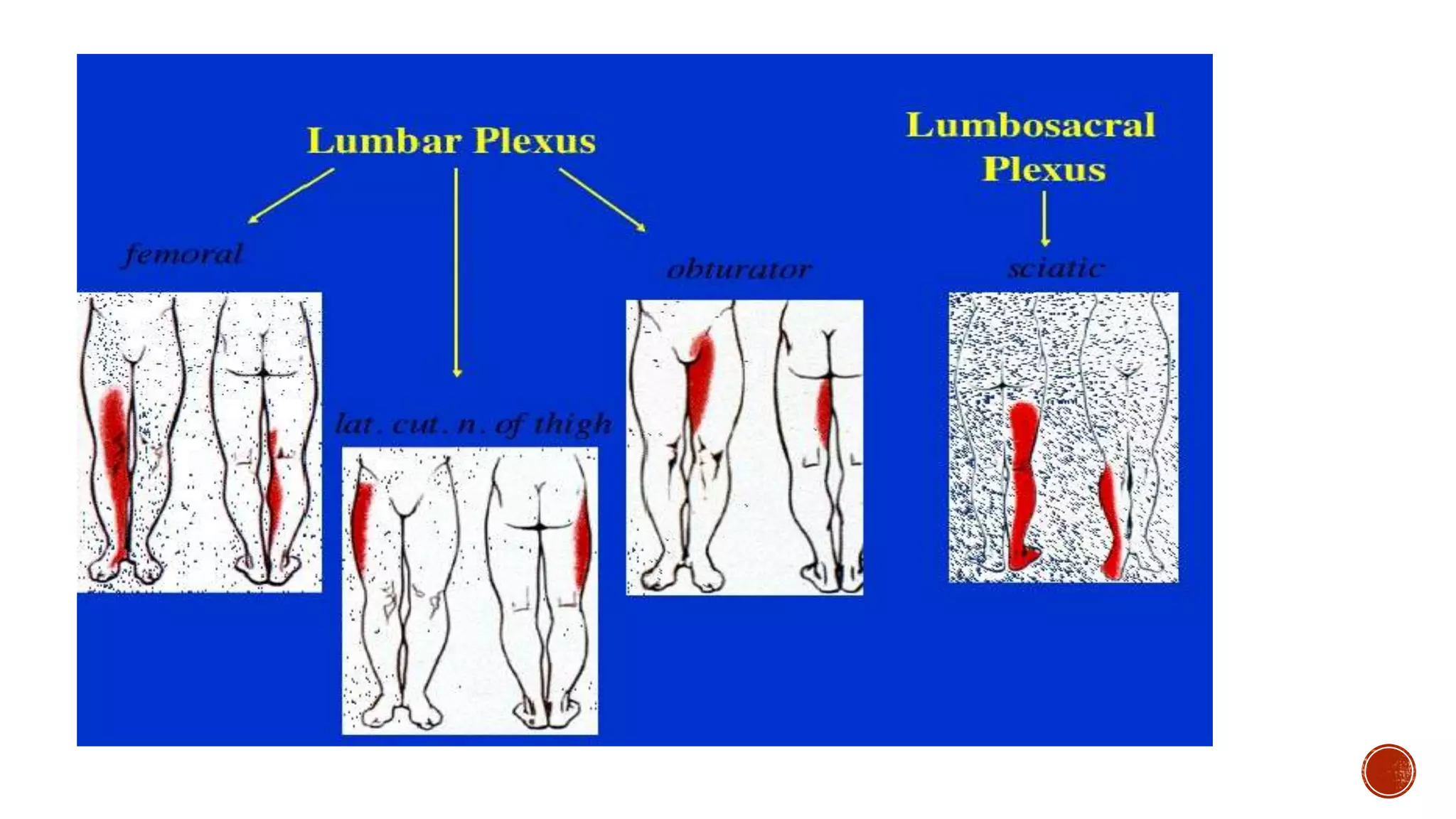 Lumbar plexus plexopathy.pptx